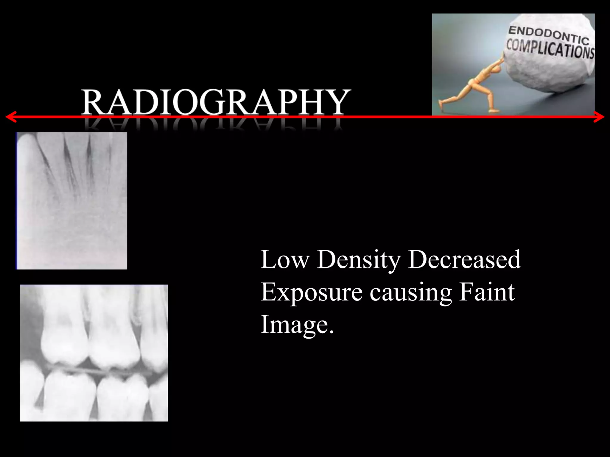 procedural errors in endodontics ppt.ppt