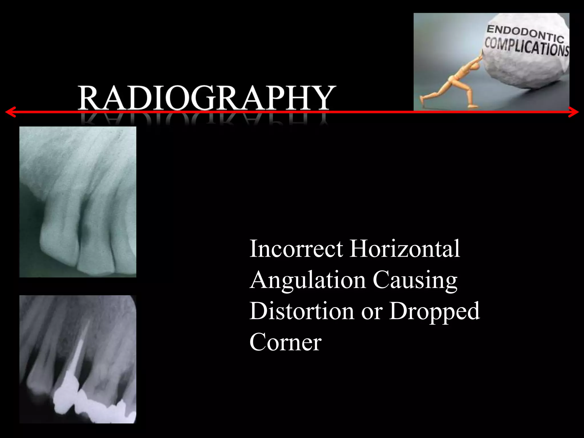 procedural errors in endodontics ppt.ppt