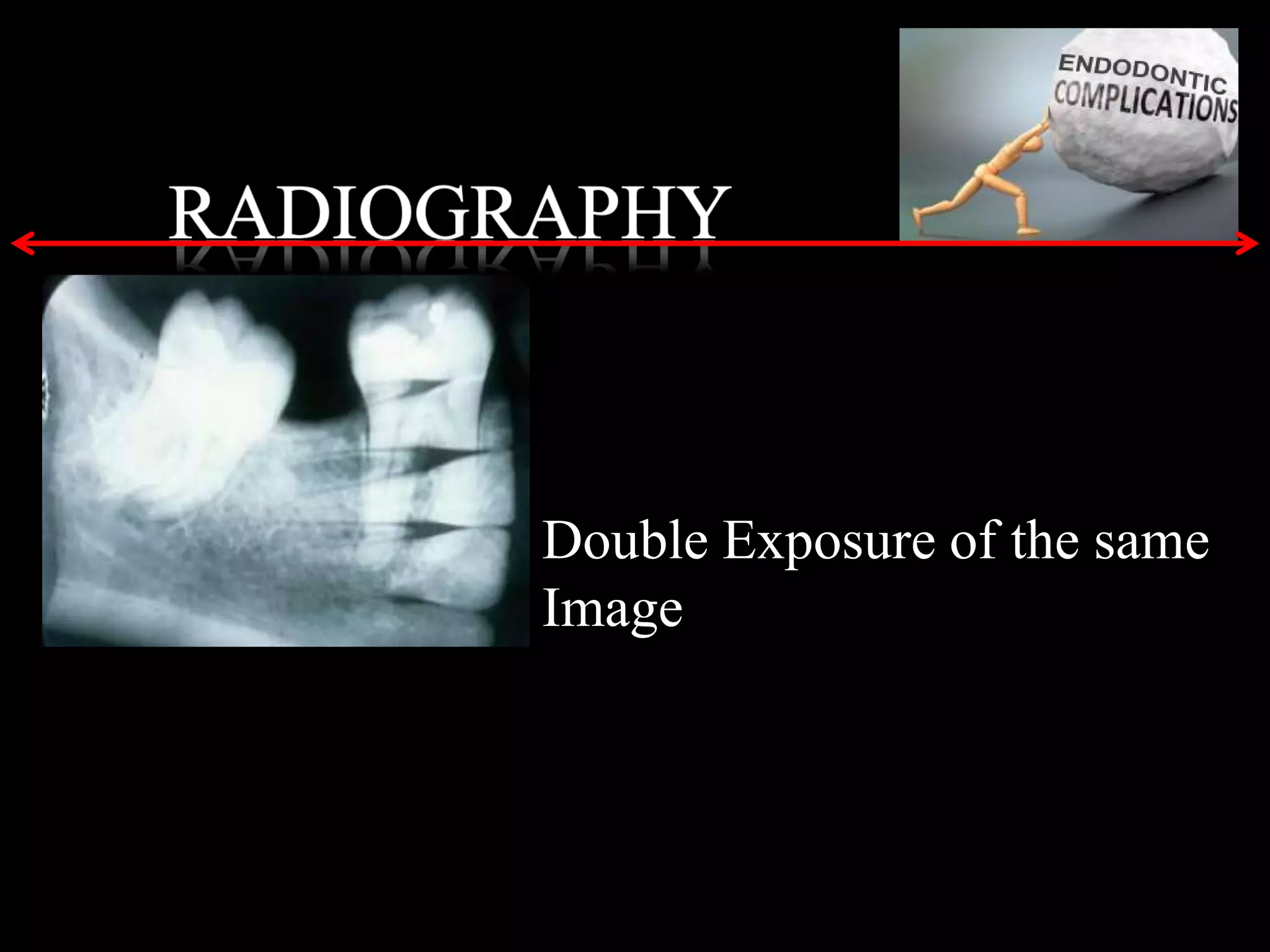 procedural errors in endodontics ppt.ppt
