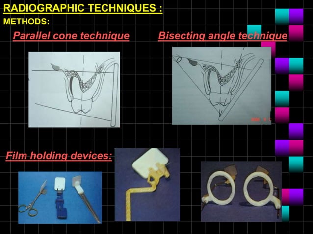 procedural errors in endodontics ppt.ppt