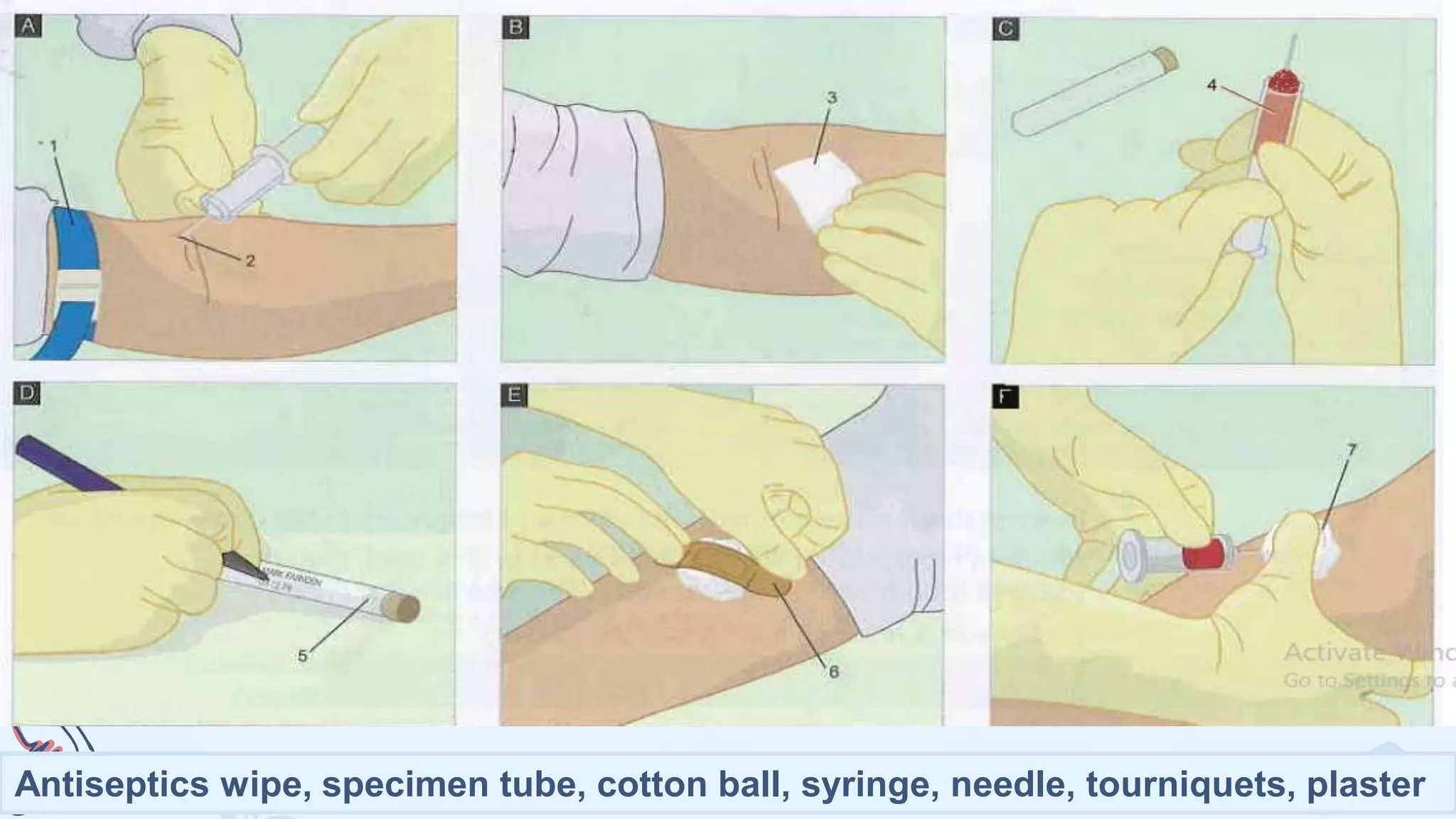English for Nusing - Treatment Procedures | PPTX