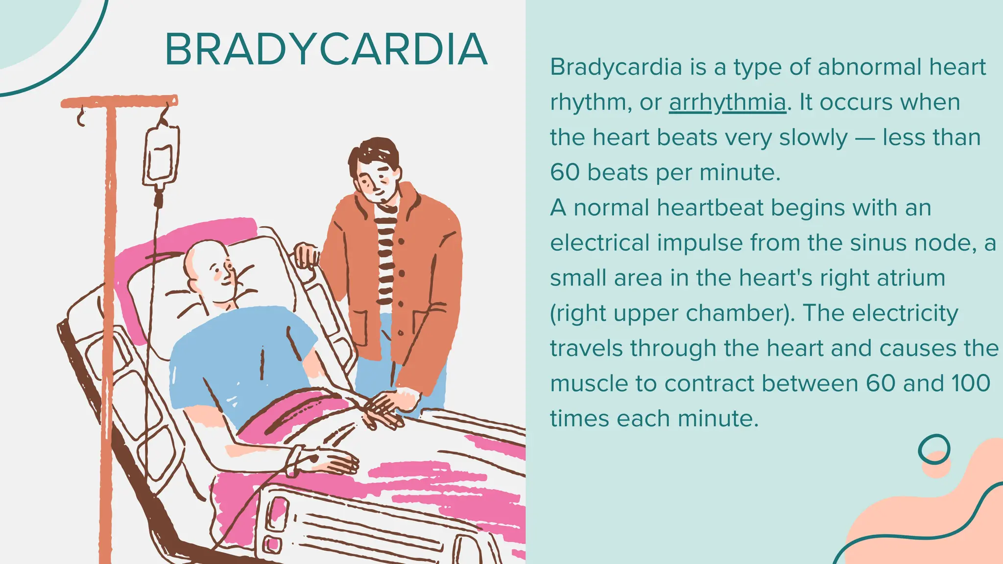 BASIC ECG RTHYM - STEMI- SVT -A FIB- SINUS BRADYCARDIA -TACHYCARDIA | PPT
