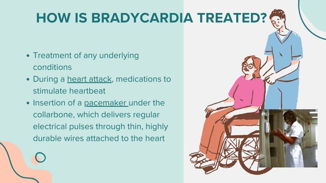 BASIC ECG RTHYM - STEMI- SVT -A FIB- SINUS BRADYCARDIA -TACHYCARDIA | PDF