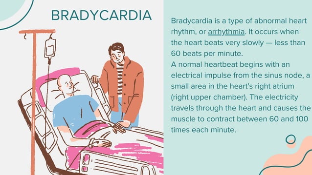 BASIC ECG RTHYM - STEMI- SVT -A FIB- SINUS BRADYCARDIA -TACHYCARDIA | PDF