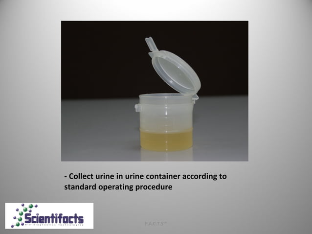 Procedure f.a.c.t.s. dipcard test | PPT