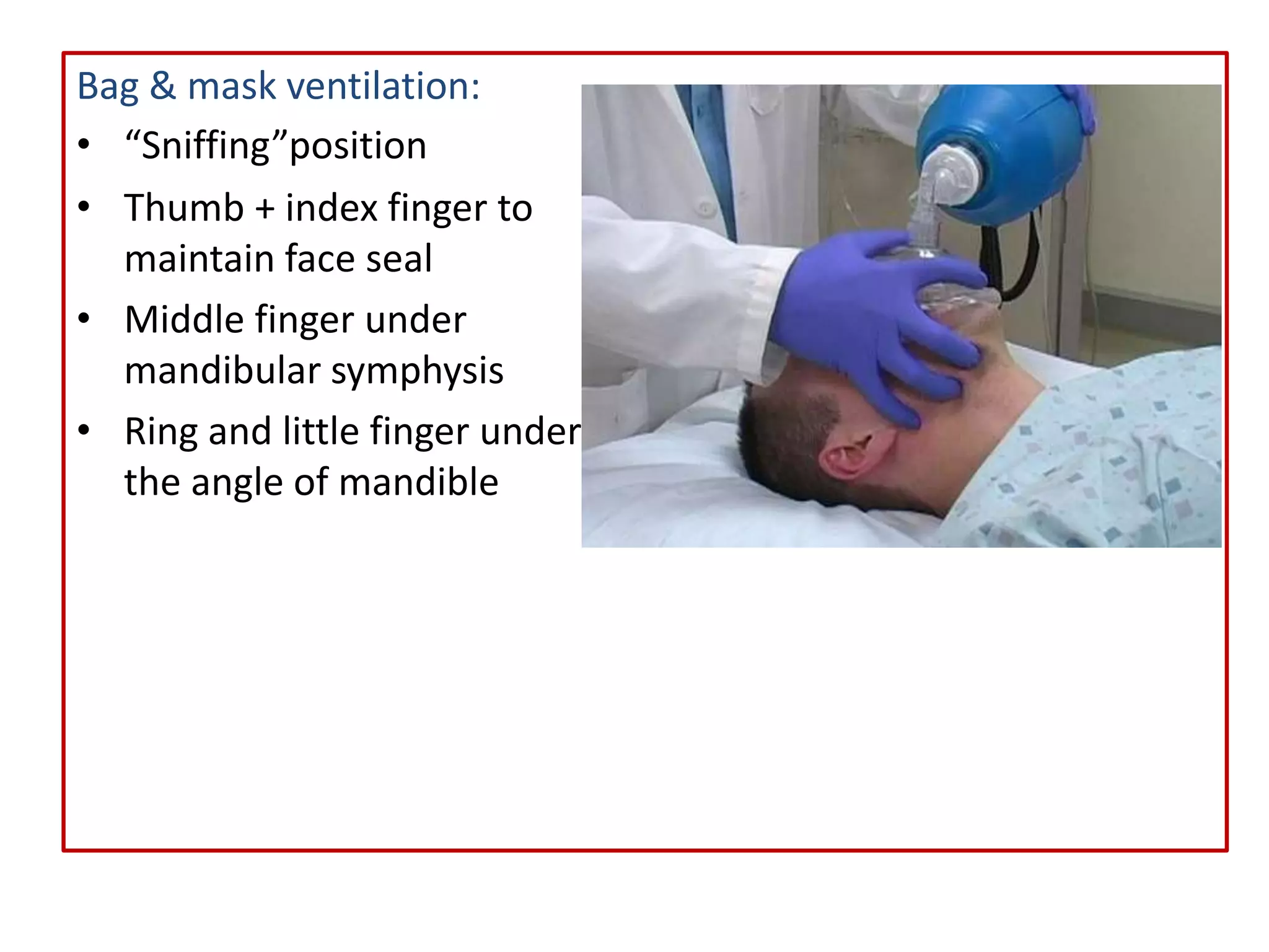 Procedures in Pediatrics | PPTX