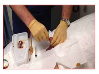 Procedures in Pediatrics | PPTX
