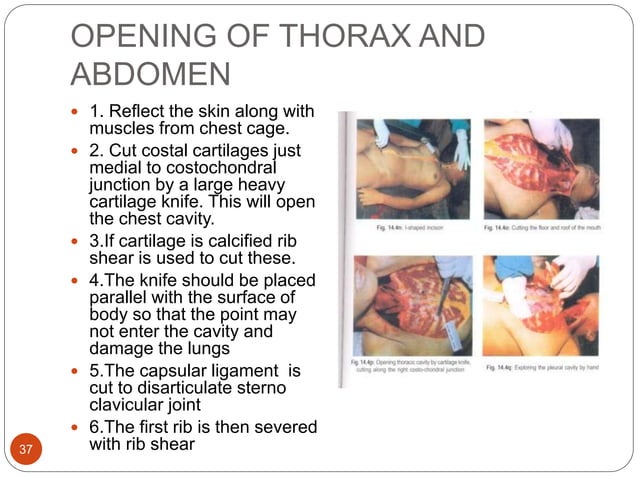 Procedure of autopsy | PPTX | Death, Injury, or Military Conflict ...