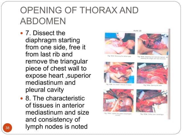 Procedure of autopsy | PPTX | Death, Injury, or Military Conflict ...