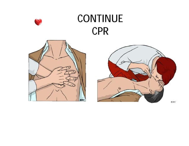 Procedure of CPR | PDF | First Aid | Injuries