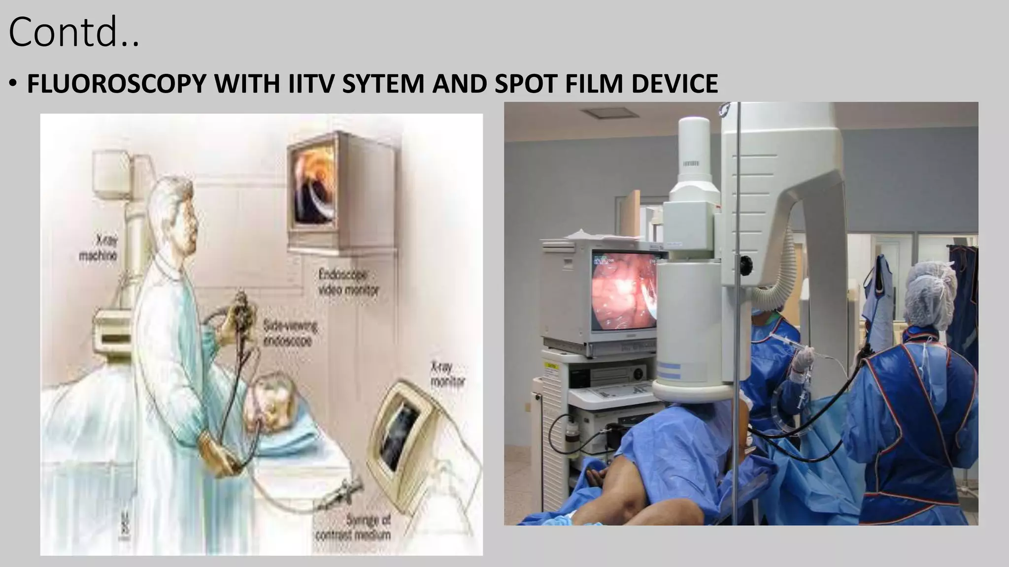 Procedure of ercp and t tube cholangiography | PPTX