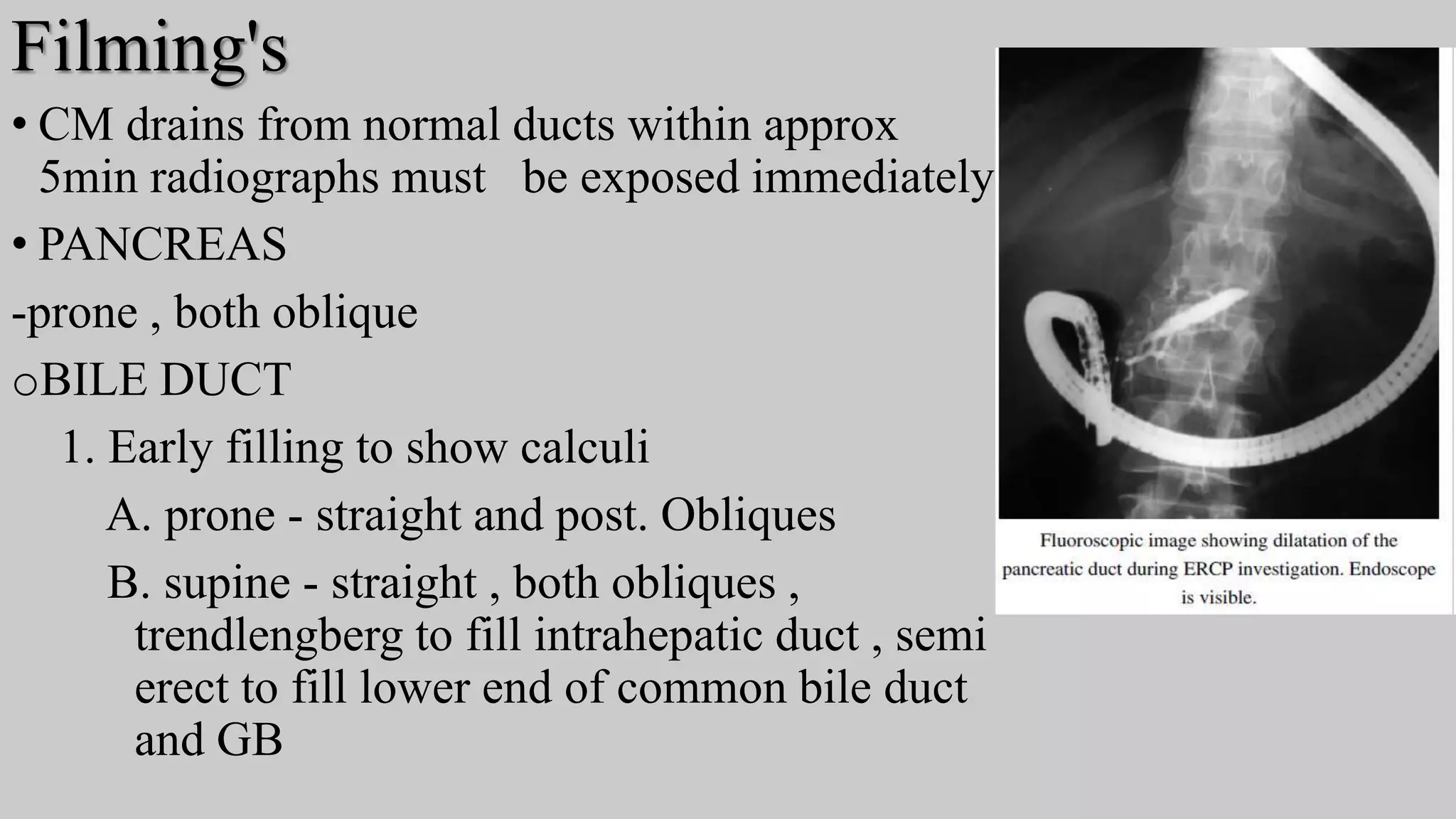 Procedure of ercp and t tube cholangiography | PPTX