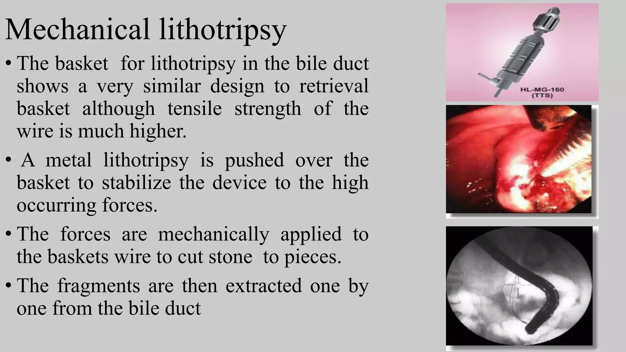 Procedure of ercp and t tube cholangiography | PPTX