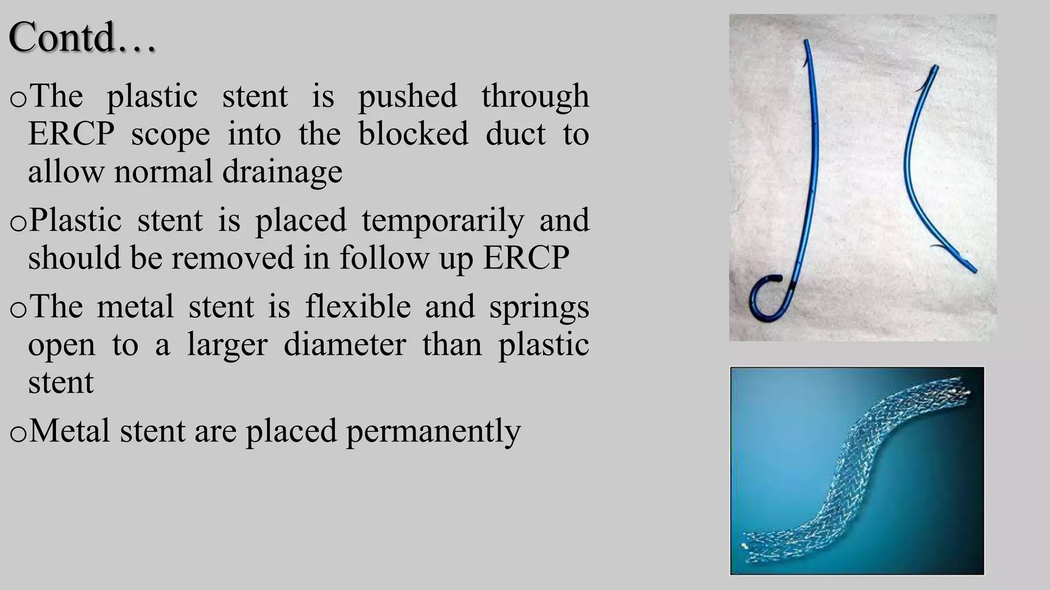 Procedure of ercp and t tube cholangiography | PPTX