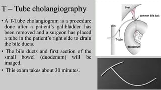 Procedure of ercp and t tube cholangiography | PPTX