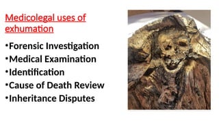 Procedure of exhumation forensic medicine.pptx