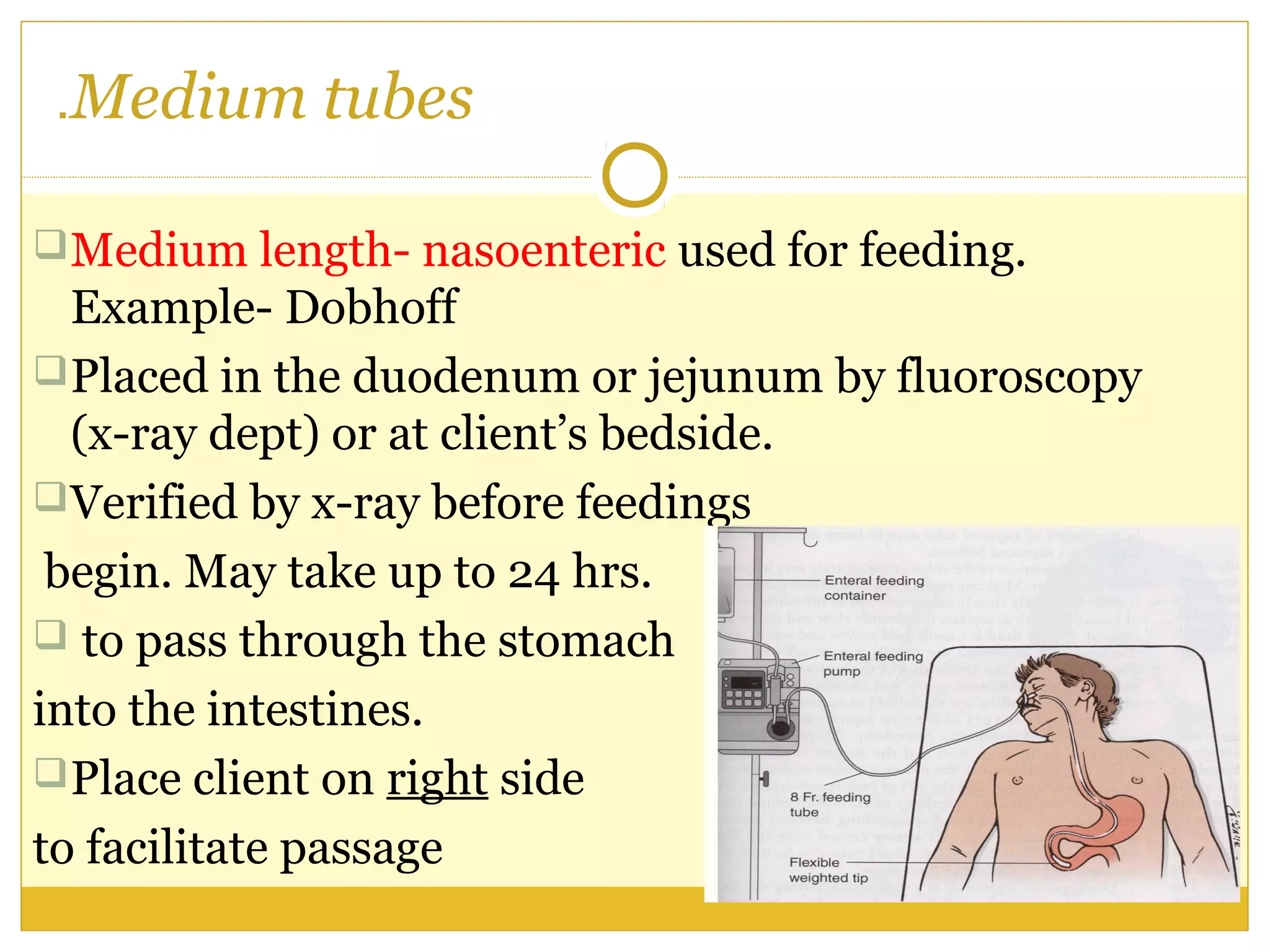 Nasogastric tube insertion | PPT
