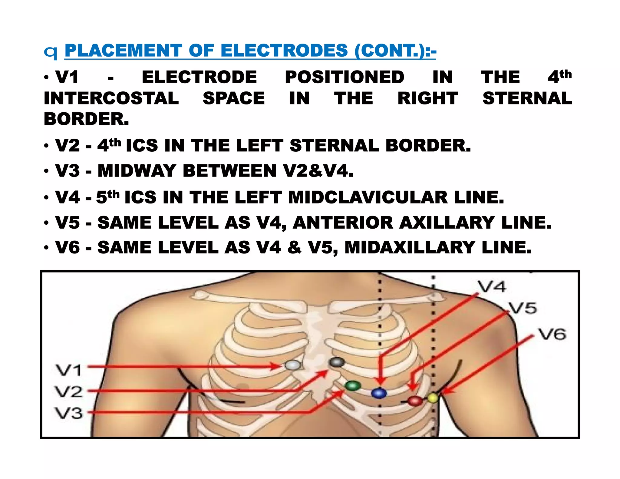 Procedure of Recording ECG | PDF