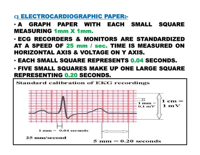 Procedure of Recording ECG | PDF | Heart and Cardiovascular Diseases ...
