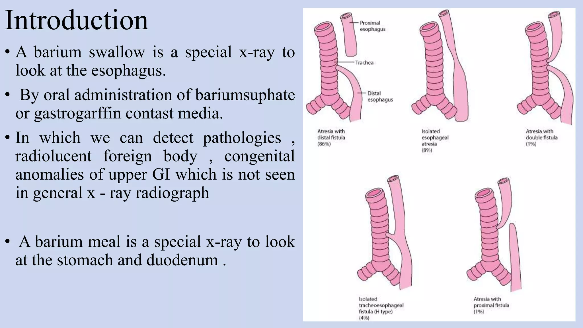 Procedure of upper gi | PPTX
