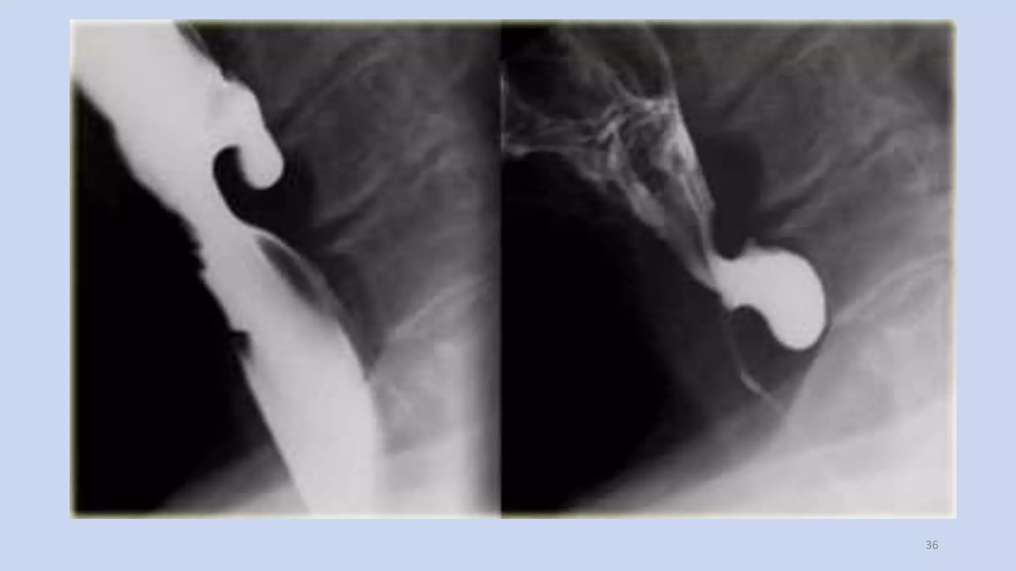 Procedure of upper gi | PPTX