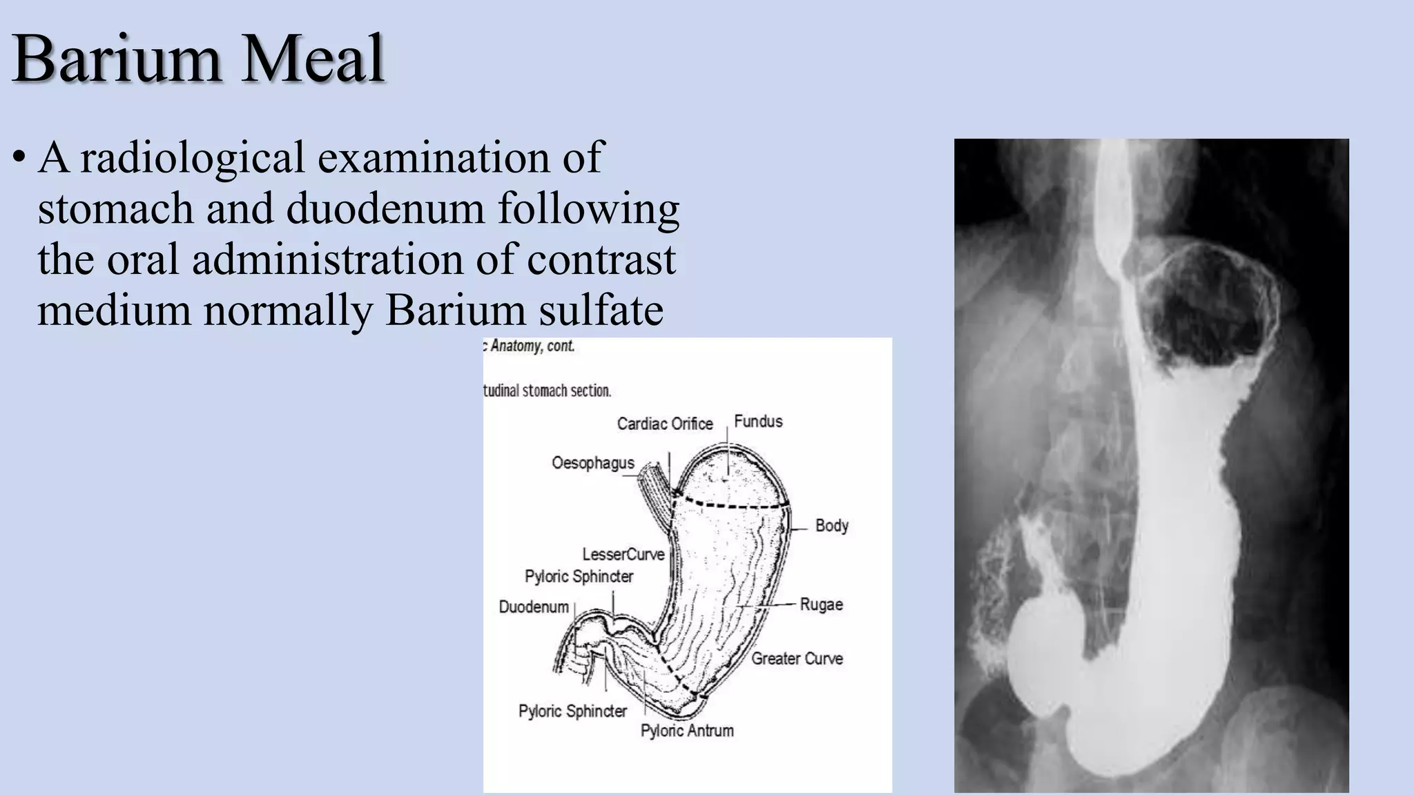 Procedure of upper gi | PPTX