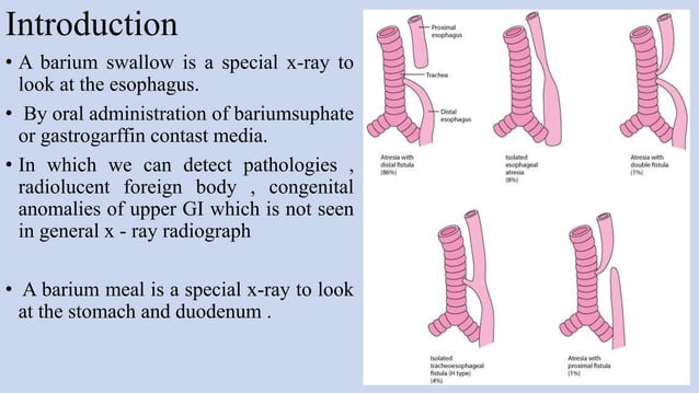 Procedure of upper gi | PPTX