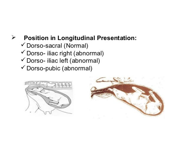 Recent advanes in handling of dystocia