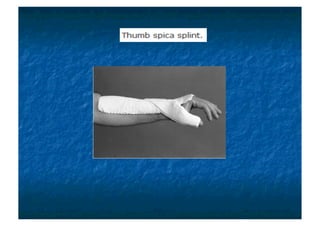 Procedures Presentation Volur splint | PDF | Surgery | Medical Health