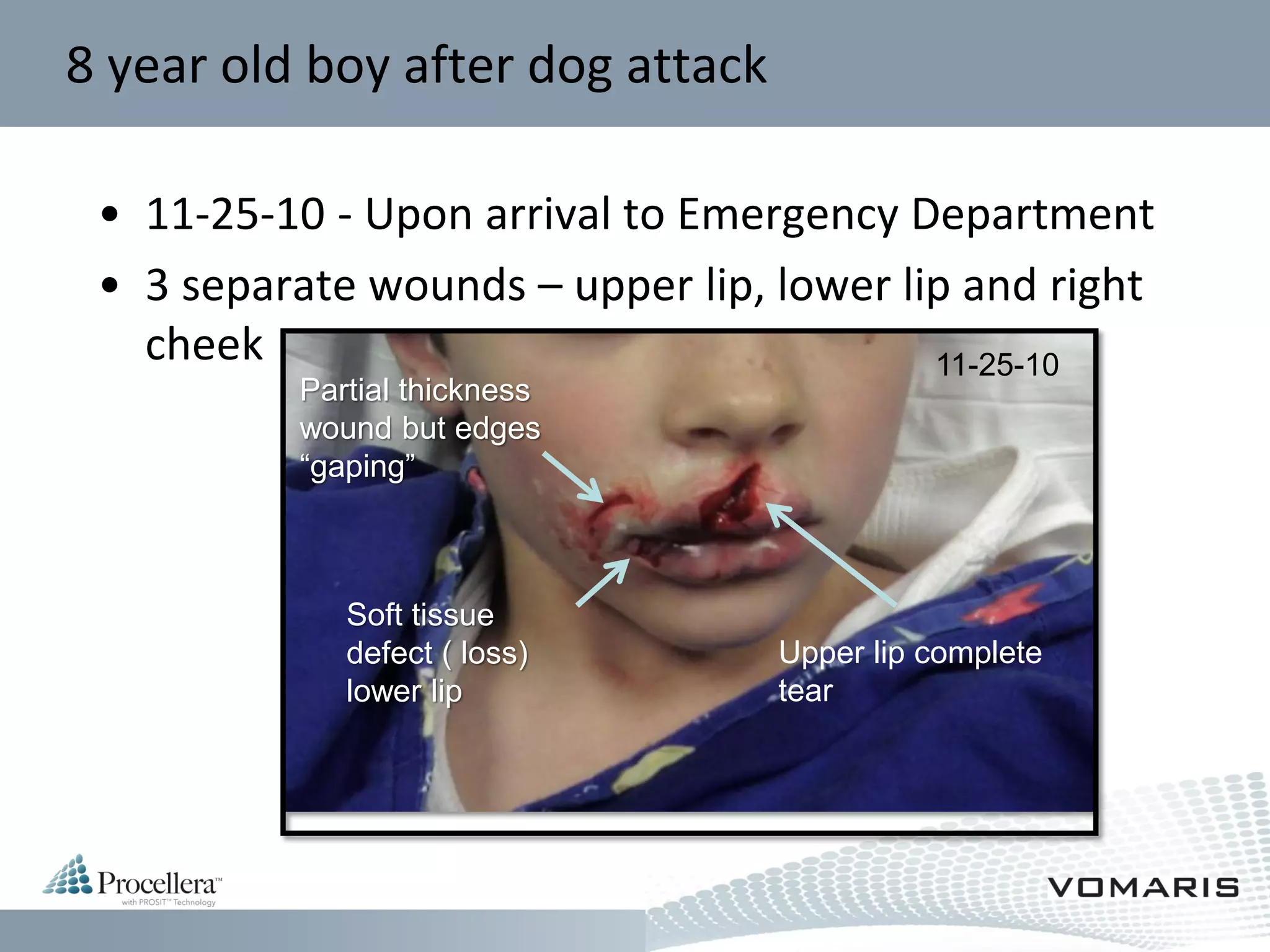 Procellera case study dogbite | PDF