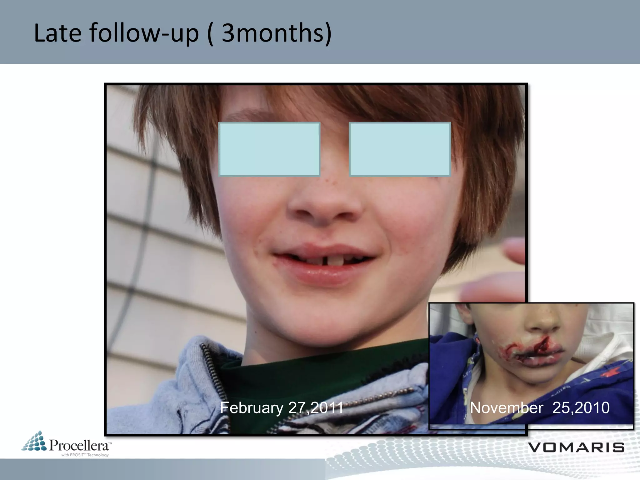 Procellera case study dogbite | PDF