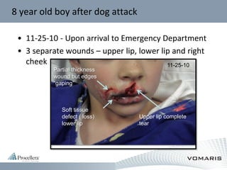 Procellera case study dogbite | PPT