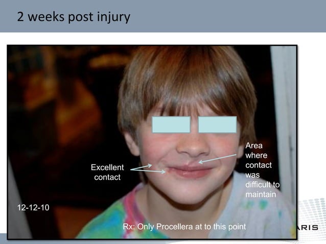 Procellera case study dogbite | PPT