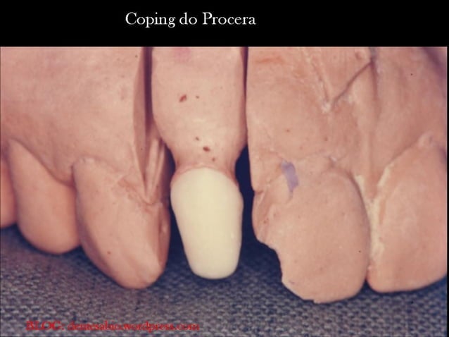 Procera coroa | PPT