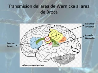 [Neurociencias] Procesamiento del lenguaje (Area de Broca y Wernicke ...