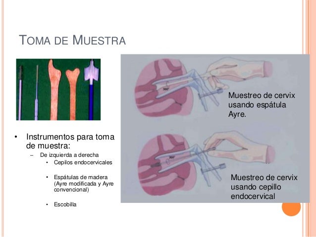 Procesamiento de muestra citológica cervicouterina