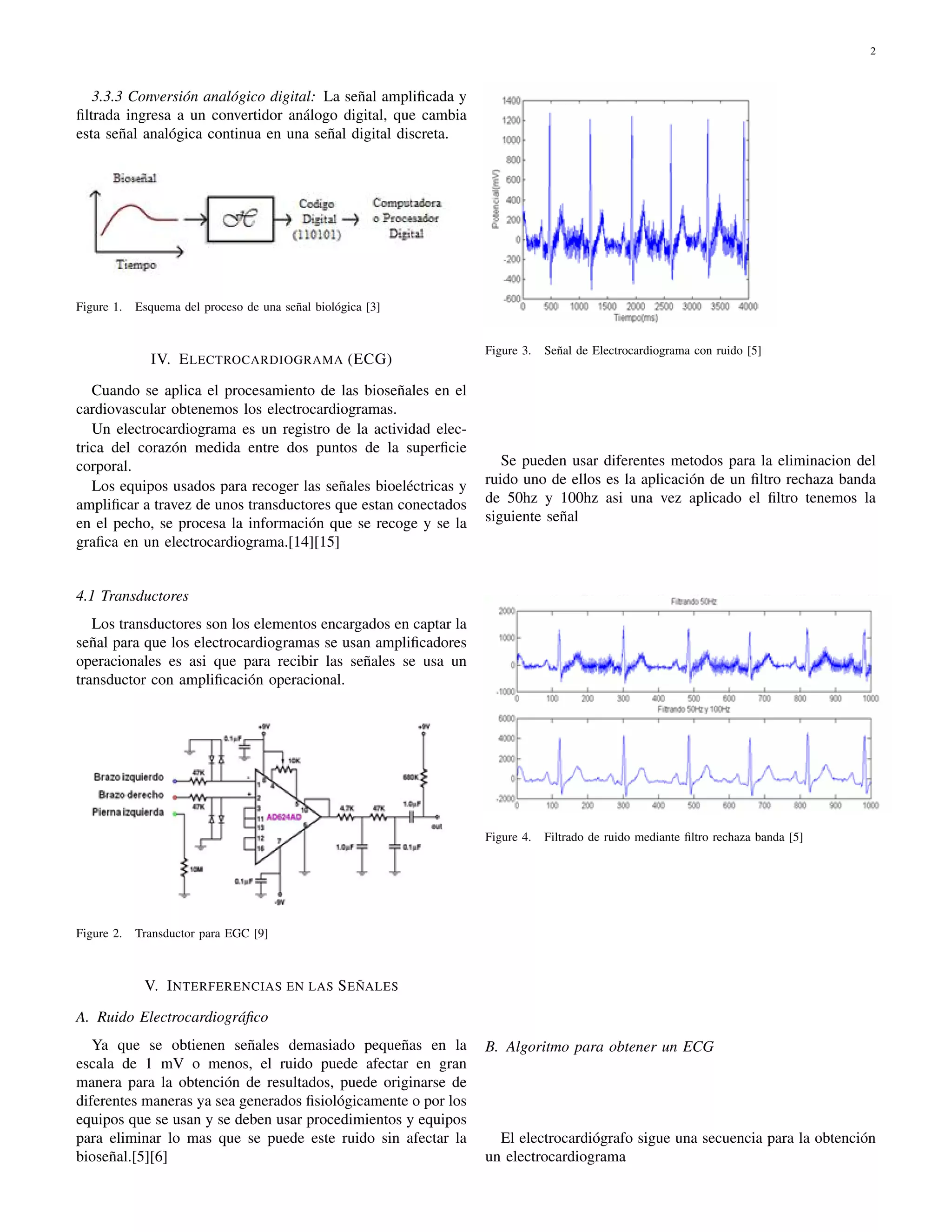 Procesamiento de señales biomédicas | PDF