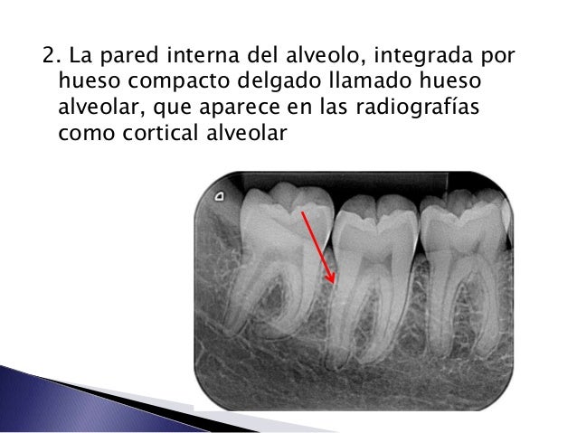 Proceso alveolar