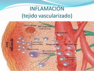 PROCESO INFLAMATORIO, RESPUESTA INMUNE Y CICATRIZACIÓN | PPTX
