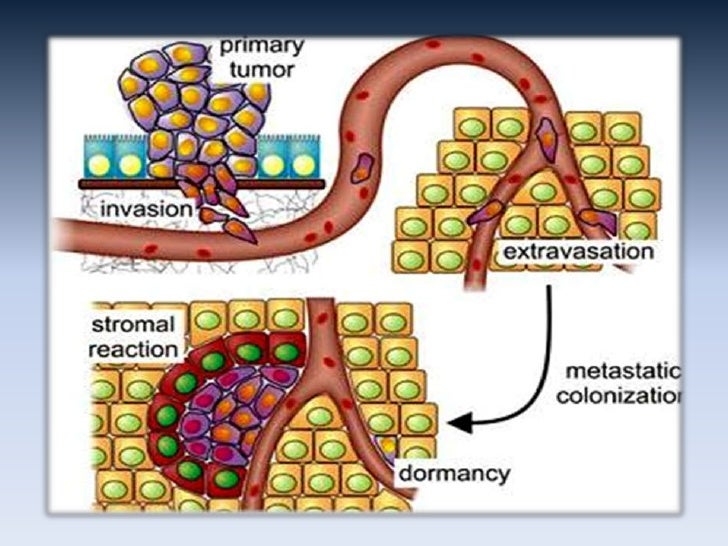 Proceso de invasión y metástasis tumoral