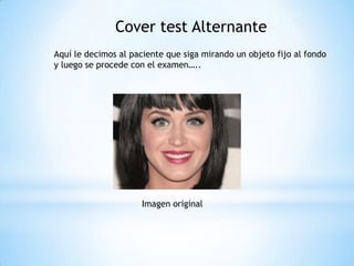Proceso de realizacion del cover test | PPTX