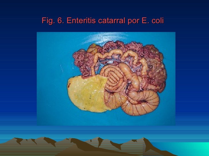 Procesos Digestivos