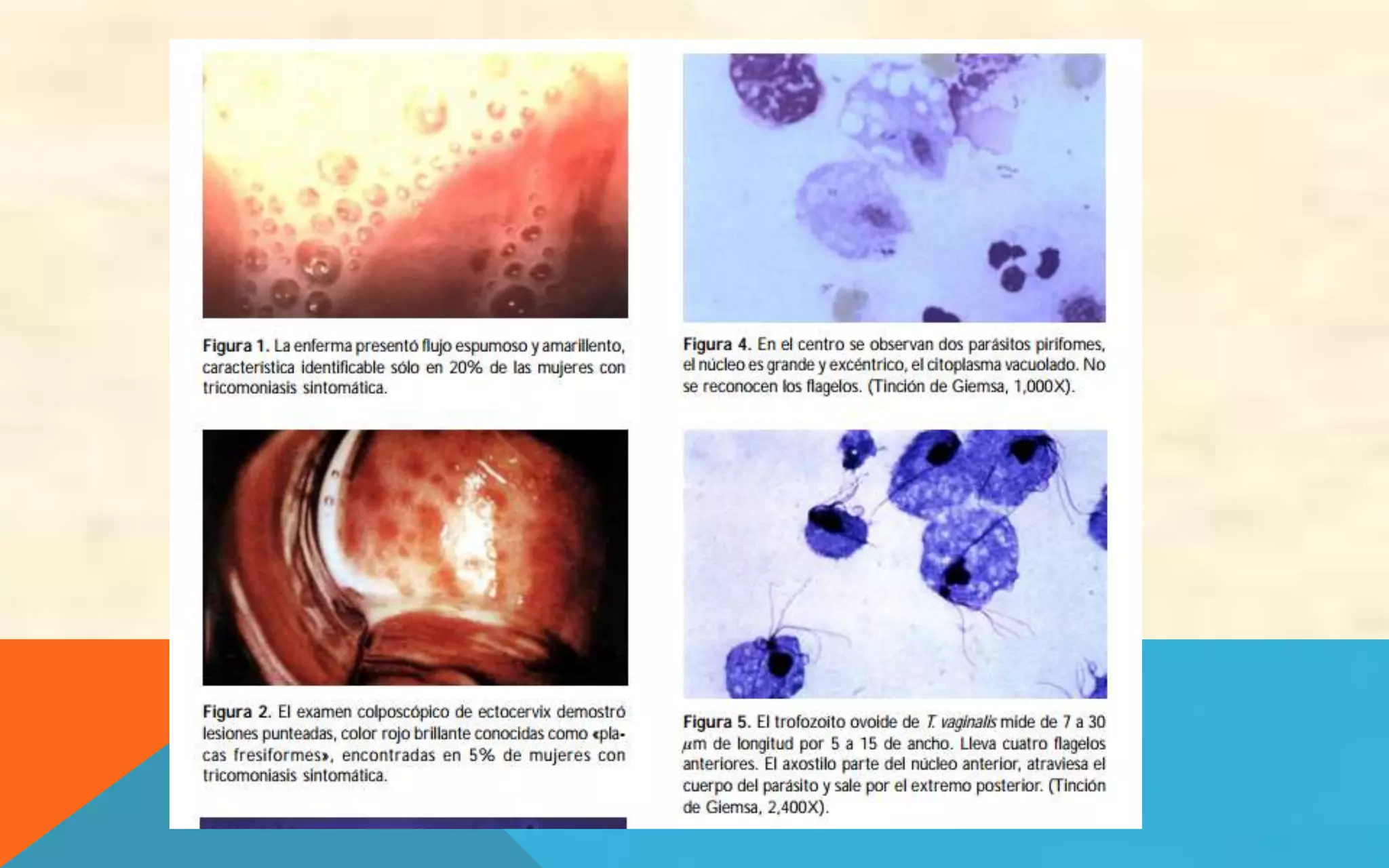 Procesos infecciosos y parasitarios parte 1 | PPTX