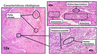Proceso tumoral Citología general.pptx