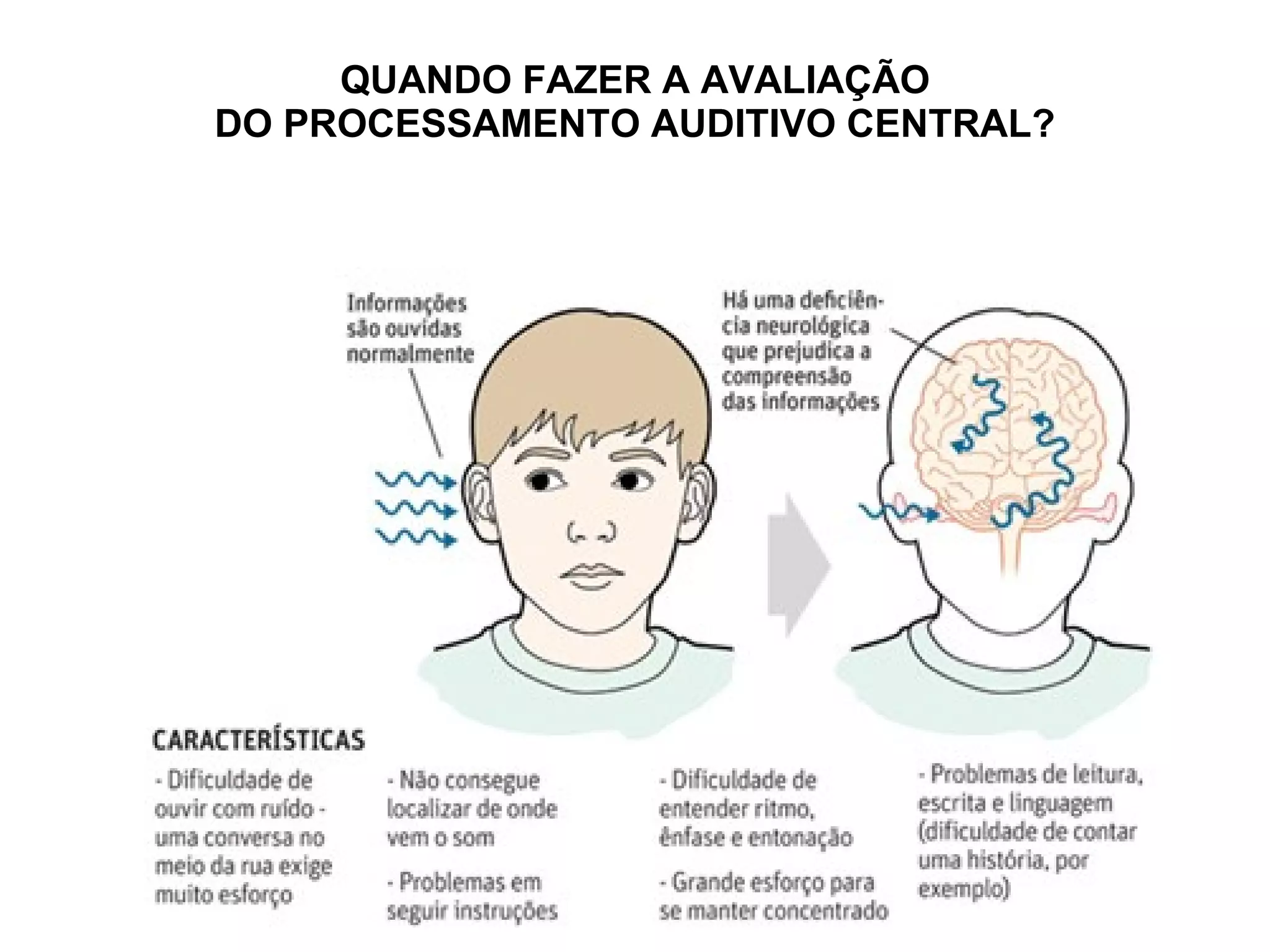 Processamento auditivo | PPT