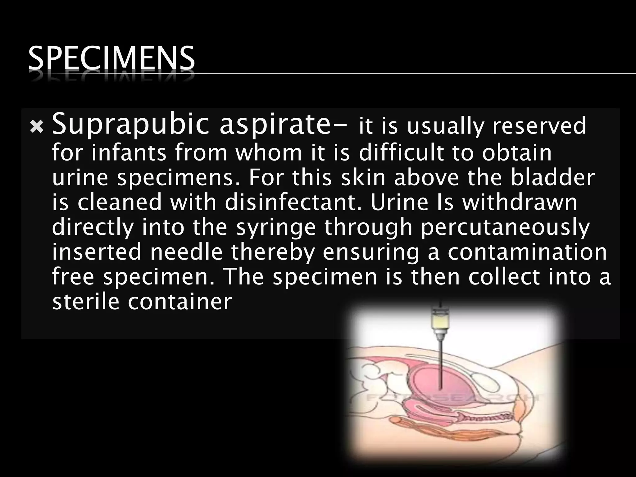 Processing of urine in microbiology by Rahul raj | PPTX
