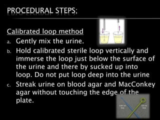 Processing of urine in microbiology by Rahul raj | PPTX