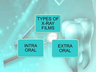 Processing of x ray film | PPTX