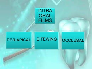 Processing of x ray film | PPTX