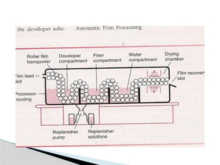 Processing of X ray Film by Dr divyesh Tarsariya ,x ray film processing ...